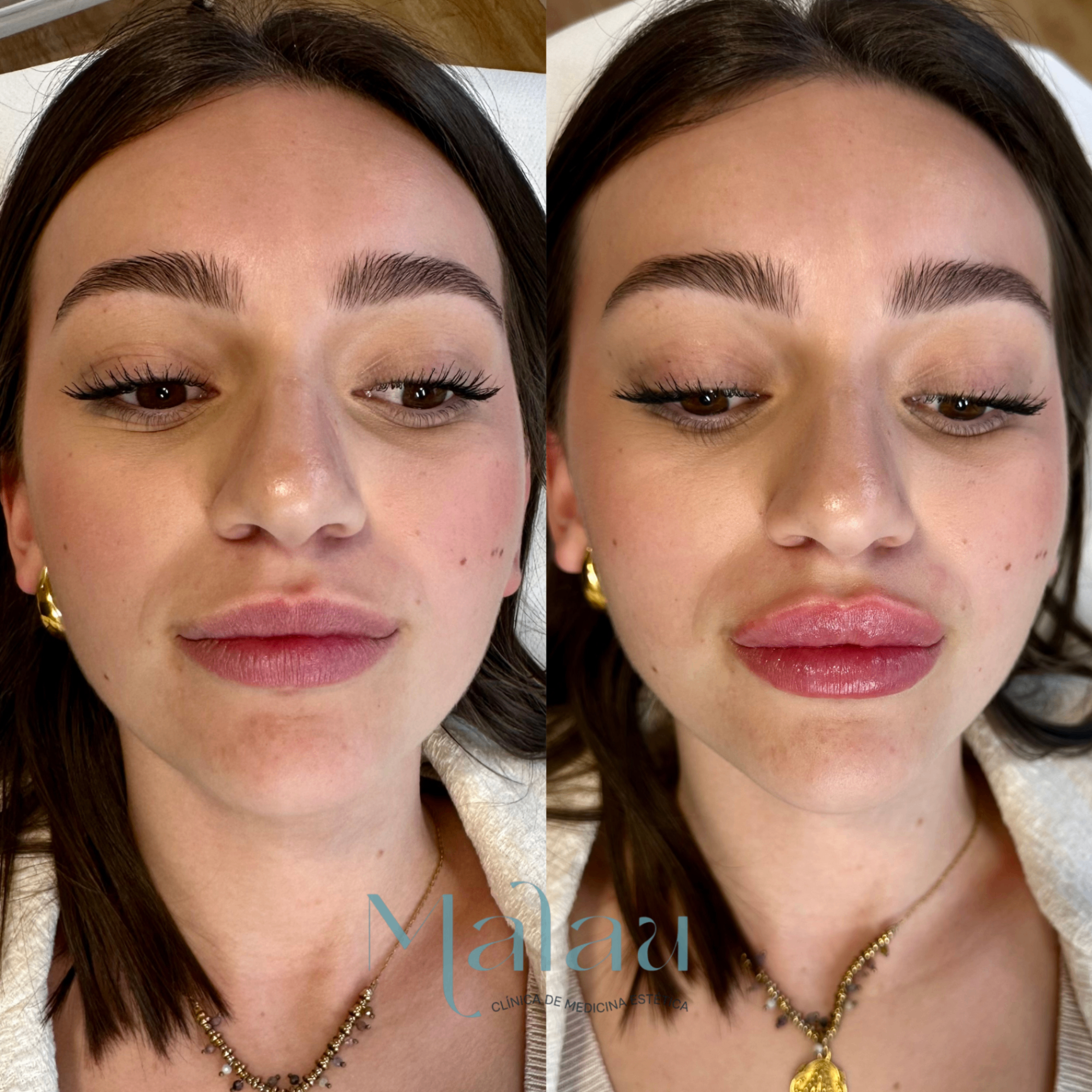 Dra. Laura Robinson | Medicina Estética Premium